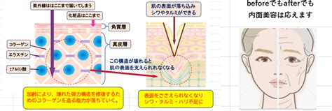 真皮 写真 397 無料写真