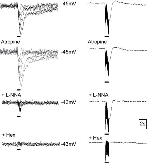 Intracellular Electrical Recordings Reveal Differences In Download