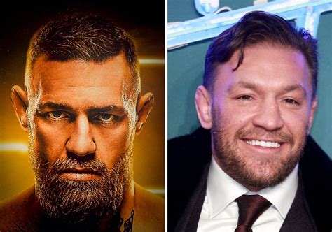 Follicular Eczema Causes Symptoms Treatment