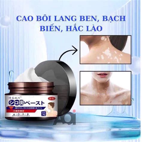 Tinea Versicolor Ointment Sakimi Topical Cream Evens Skin Tone