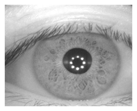 Examples Of The Iris Localization Results Of The Proposed Algorithm Download Scientific Diagram