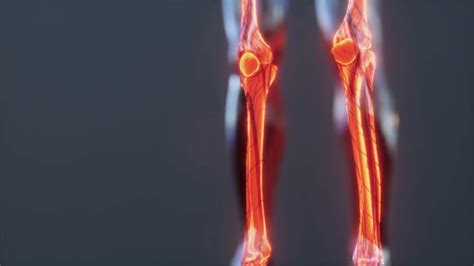 Nerve Sciatica Animation Stock Footage Royalty Free Video Clips