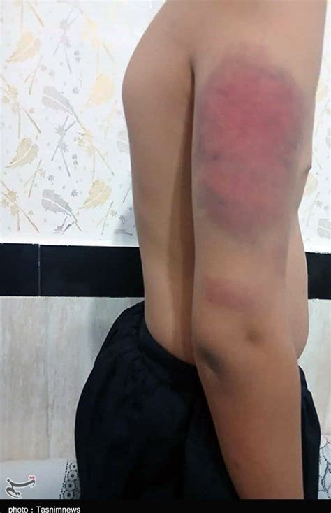 تصاویری دلخراش از تنبیه بدنی دانش‌آموزان توسط یک معلم در سنندج کار یک