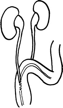 Ureterosigmoid Anastomosis Risk Of Colorectal Cancer And Implications