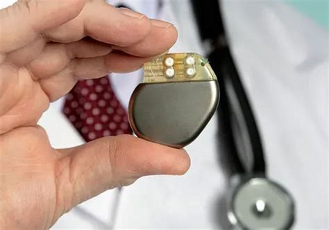 Pacemaker Implant Murray Hill Heart Rhythm Treatment New York City