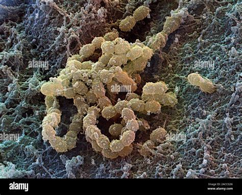 Streptococcus Mutans Coloured Scanning Electron Micrograph Sem Of