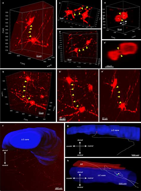 Potential Routes For Spreading Of Hyperphosphorylated Tau At8⁺cell Download Scientific Diagram