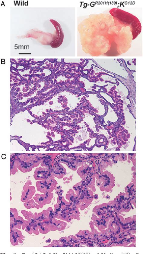 Figure 2 From Development Of A Genetically Engineered Mouse Model Of Intraductal Papillary