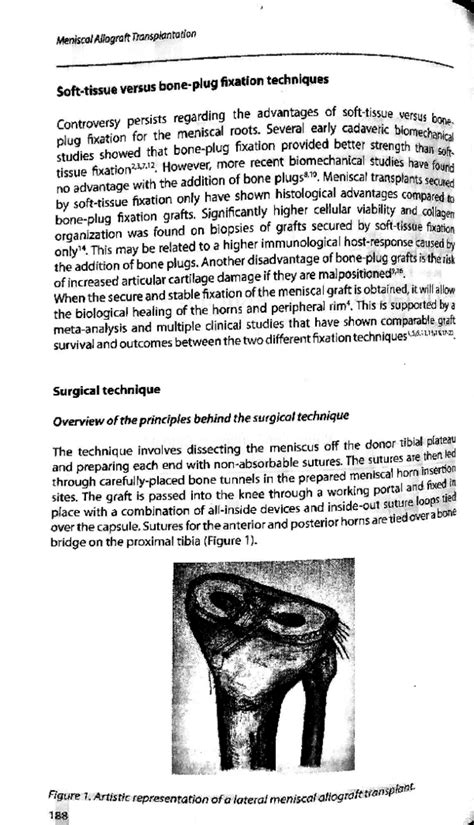 Pdf Meniscus Allograft Transplantation