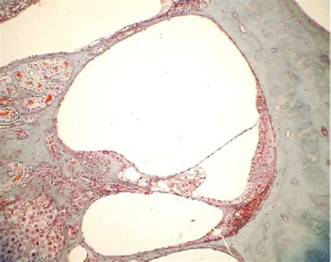 Cochlear Cross Section Diagram Quizlet