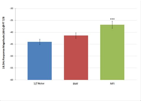 Response Magnitude In DbV For Each Condition There Is A Significant Download Scientific