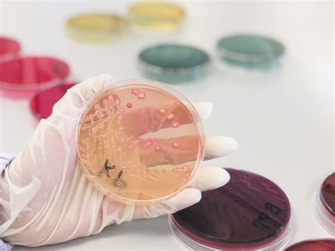 Enterococcus Faecalis Colony Morphology