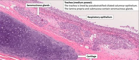 Trachea Histology Diagram