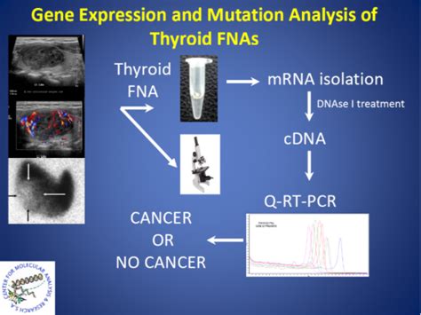 Thyroid Fna Diagnostics Study Center For Molecular Analysis And Research