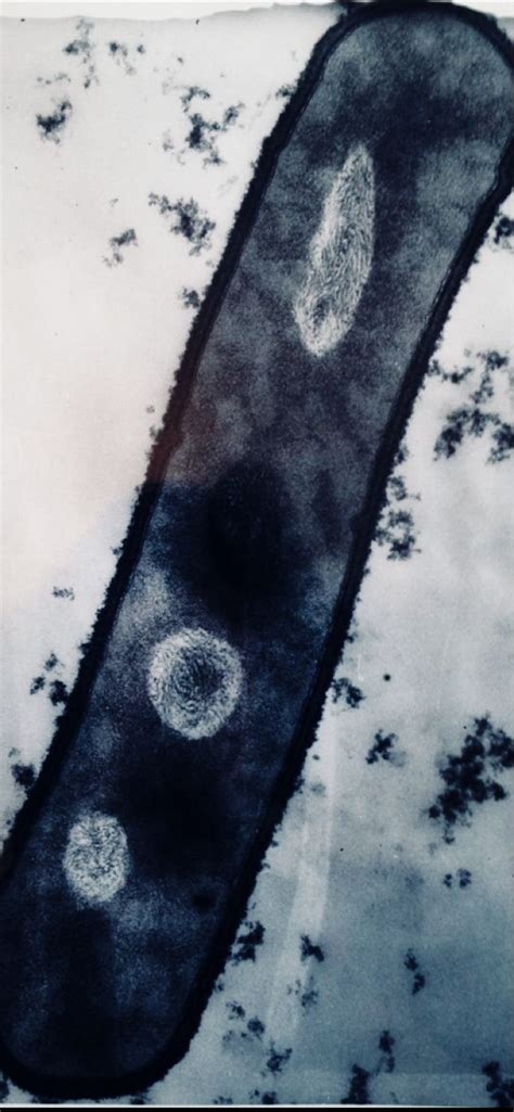Exploring Microbiology With Bacillus Subtilis Amir Mohammad Rezaei Posted On The Topic Linkedin