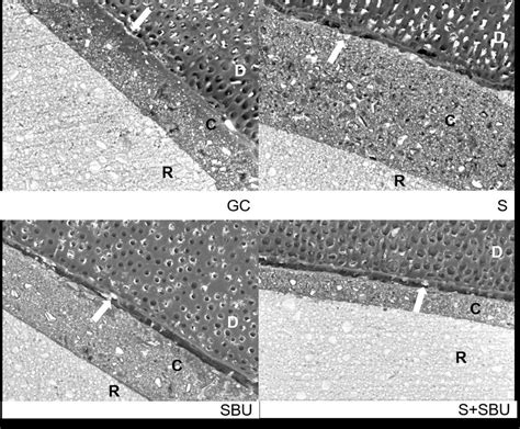 Photomicrograph Sem With 1000x Magnification Showing The Adhesive Download Scientific