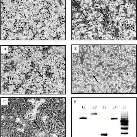 Propagation Of Dengue Virus Dv Dengue Virus Were Allowed To Download Scientific Diagram