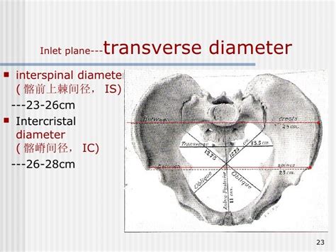 Anteroposterior Diameter