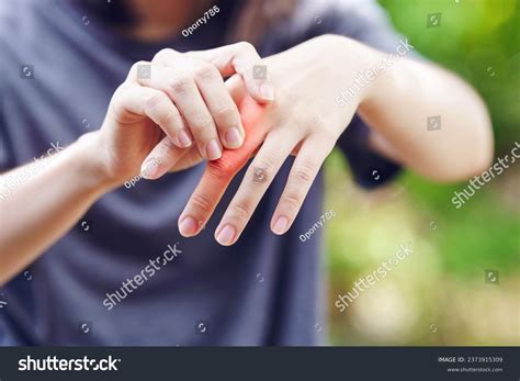 Woman Touches Painful Knuckle Caused By Stock Photo Shutterstock