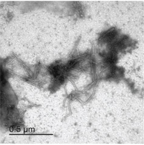 Tem Data Collected At The Plateau Of The Reactions Of Amyloid Fibril Download Scientific