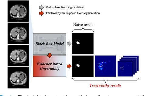 Trustworthy Multi Phase Liver Tumor Segmentation Via Evidence Based