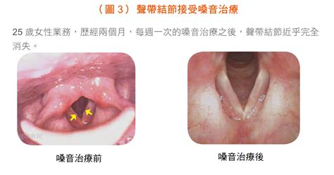 王棨德醫師嗓音治療團隊
