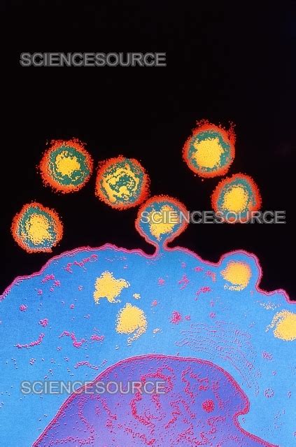 Aids Virus Budding Stock Image Science Source Images