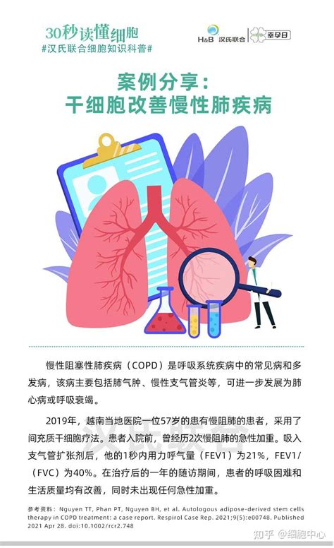 汉氏联合细胞知识科普：案例分享：干细胞改善慢性肺疾病 知乎