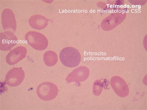 Eritrocito PolicromatofÍlico Fichero De Hematología