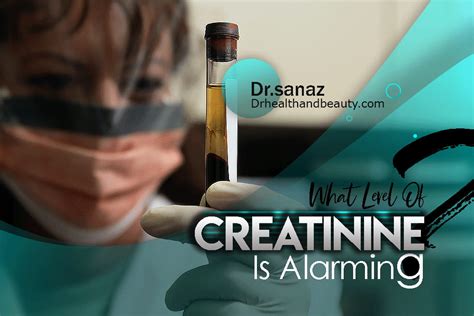 What Level Of Creatinine Is Alarming Drhealthandbeauty