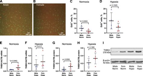 Transcriptomics And Proteomics Revealed Sex Differences In Human