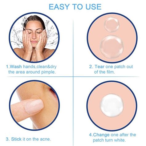 Ultra Thin Daily Pressure Acne Patch Manufacturer China Acne And Ultra Thin Acne Patch Price