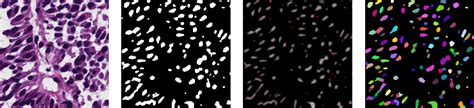 self supervised nuclei segmentation in histopathological images using