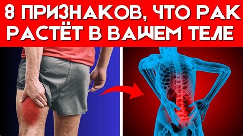 Не Пропустите Эти 8 Ранних Признаков Рака Это Может Спасти Вам Жизнь Youtube