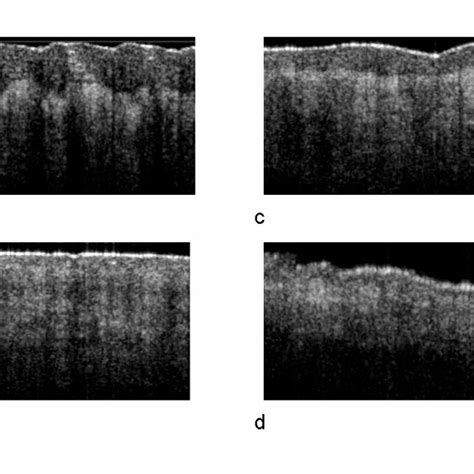 A Schematic Diagram Of Thorlabs Swept Source Optical Coherence System Download Scientific