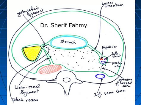 The Peritoneum Anatomy Of The Abdomen Pps