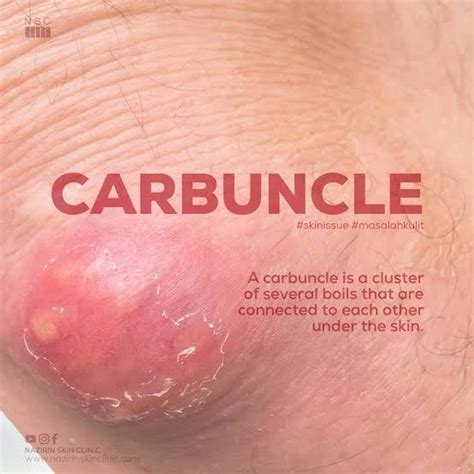 Md Ismail Hossain Sojib On Linkedin Sojib Labtechnologistassociation Labtechnologistsojib…