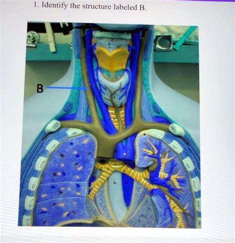 SOLVED Identify The Structure Labeled B B