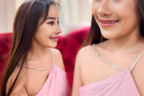 จำแทบไม่ได้ หนูรัตน์ อัพเดทภาพล่าสุด หลังศัยกรรมผ่านไปสองเดือน เริ่มเข้าที่เข้าทาง