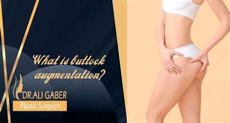 What Is Buttock Augmentation Dr Ali Gaber Plastic Surgeon And Body Sculpting Specialist