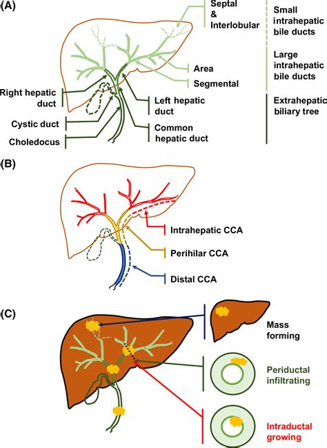 Anatomical Histomorphological And Molecular Classification Of Cholangiocarcinoma Kendall