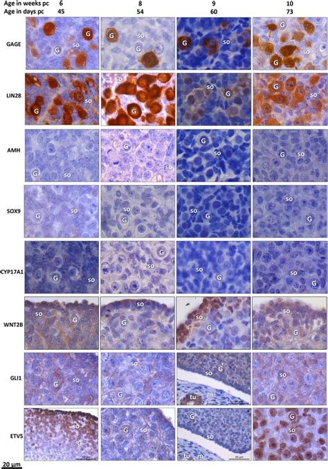 Immunohistochemical Detection Of Specific Markers In Human Embryonic Download Scientific
