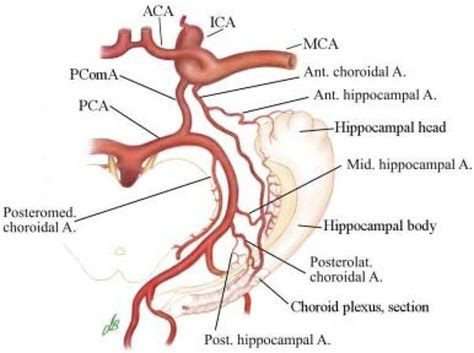 Posterior Choroidal Arteries Medical Anatomy Brain Anatomy Radiology Imaging
