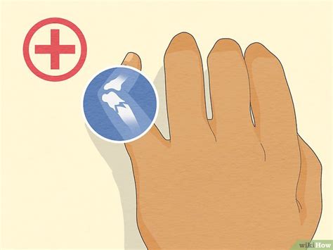 How To Determine If A Finger Is Broken Symptoms More