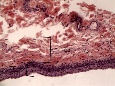 Urinary Bladder 10x Histology
