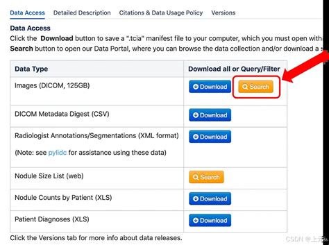 基于图像分割的lidc Idri 数据集预处理之数据下载篇lidc Idri数据集下载 Csdn博客