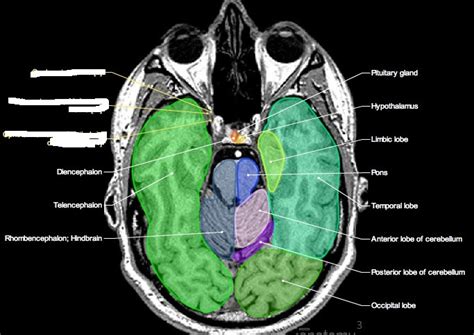 Cranial Nerve 4 Diagram Quizlet Cranial Nerve 4 Diagram Quizlet