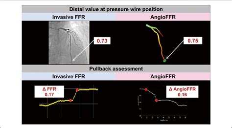 case example upper invasive fractional flow reserve ffr and