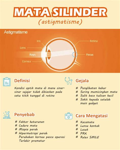 Waspada Penyebab Mata Silinder Ini Gejala Dan Cara Mengatasinya