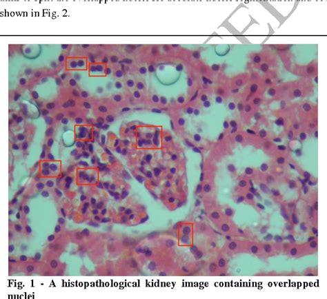 Figure 1 From A Novel Overlapped Nuclei Splitting Algorithm For
